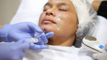 Keunggulan Filler Dagu untuk Membuat Wajah Tampak Proporsional – NOVIS News